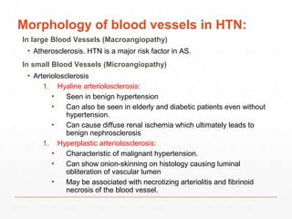 CVS pathology -4 Hypertension (HTN) 2019, sufia husain | PPT