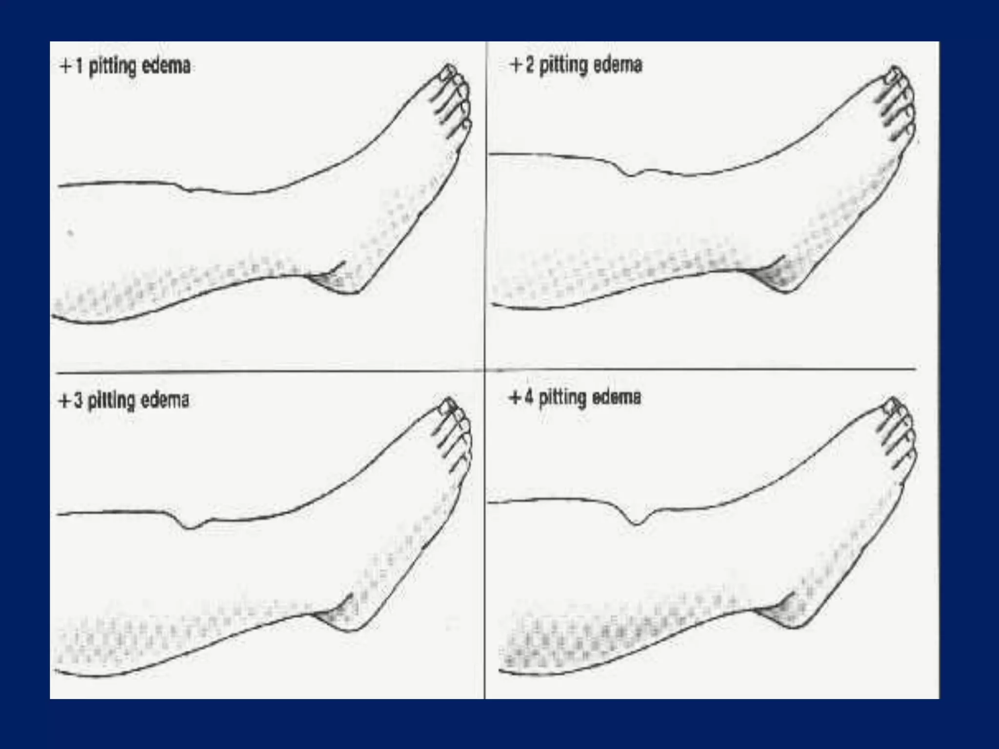 4-patho_lymphedema.pdf | Free download