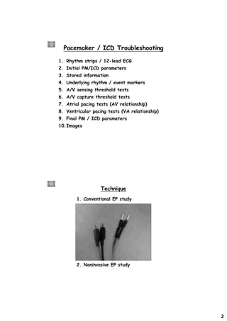 Electrophysiologic Study for Pacemaker Implantation | PDF