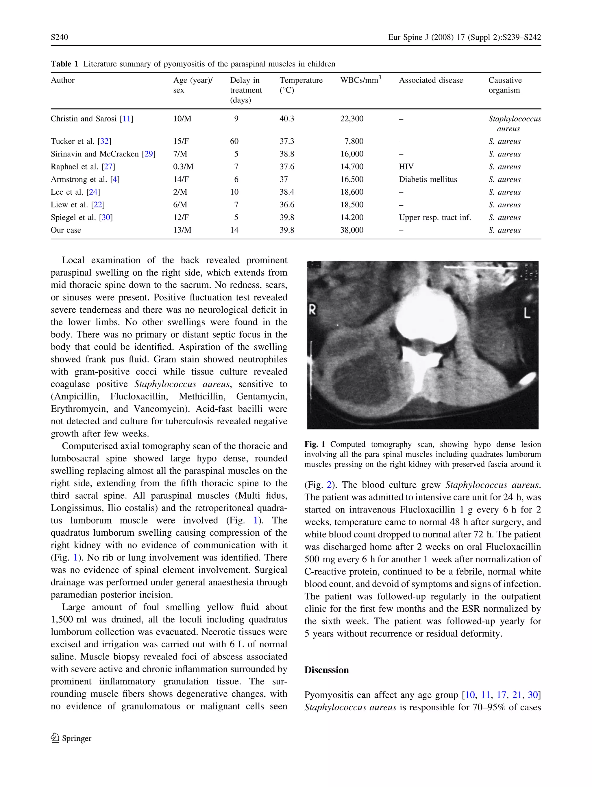 Primary pyomyositis of the paraspinal muscles - البروفيسور فريح ابوحسان ...