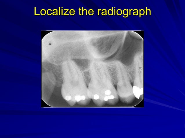 Principles Of Radiographic Interpretation | PPSX | Dental Health ...