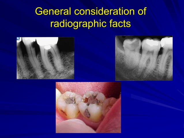Principles Of Radiographic Interpretation | PPSX | Dental Health ...