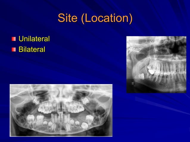 Principles Of Radiographic Interpretation | PPSX | Dental Health ...