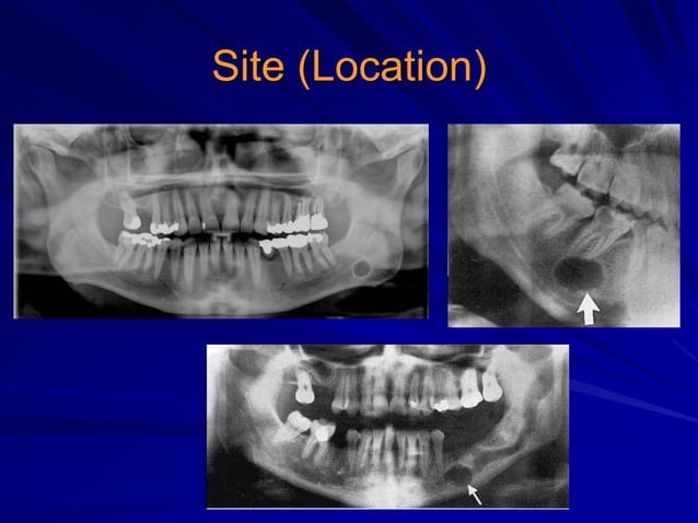 Principles Of Radiographic Interpretation | PPSX | Dental Health ...