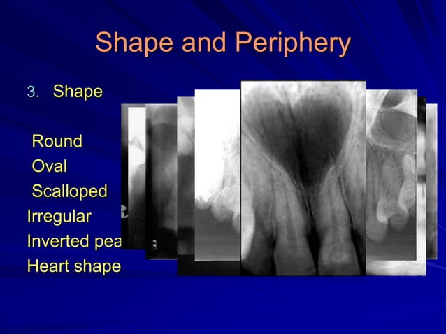 Principles Of Radiographic Interpretation | PPSX | Dental Health ...