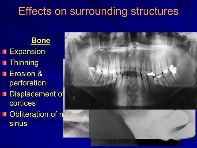 Principles Of Radiographic Interpretation | PPSX | Dental Health ...