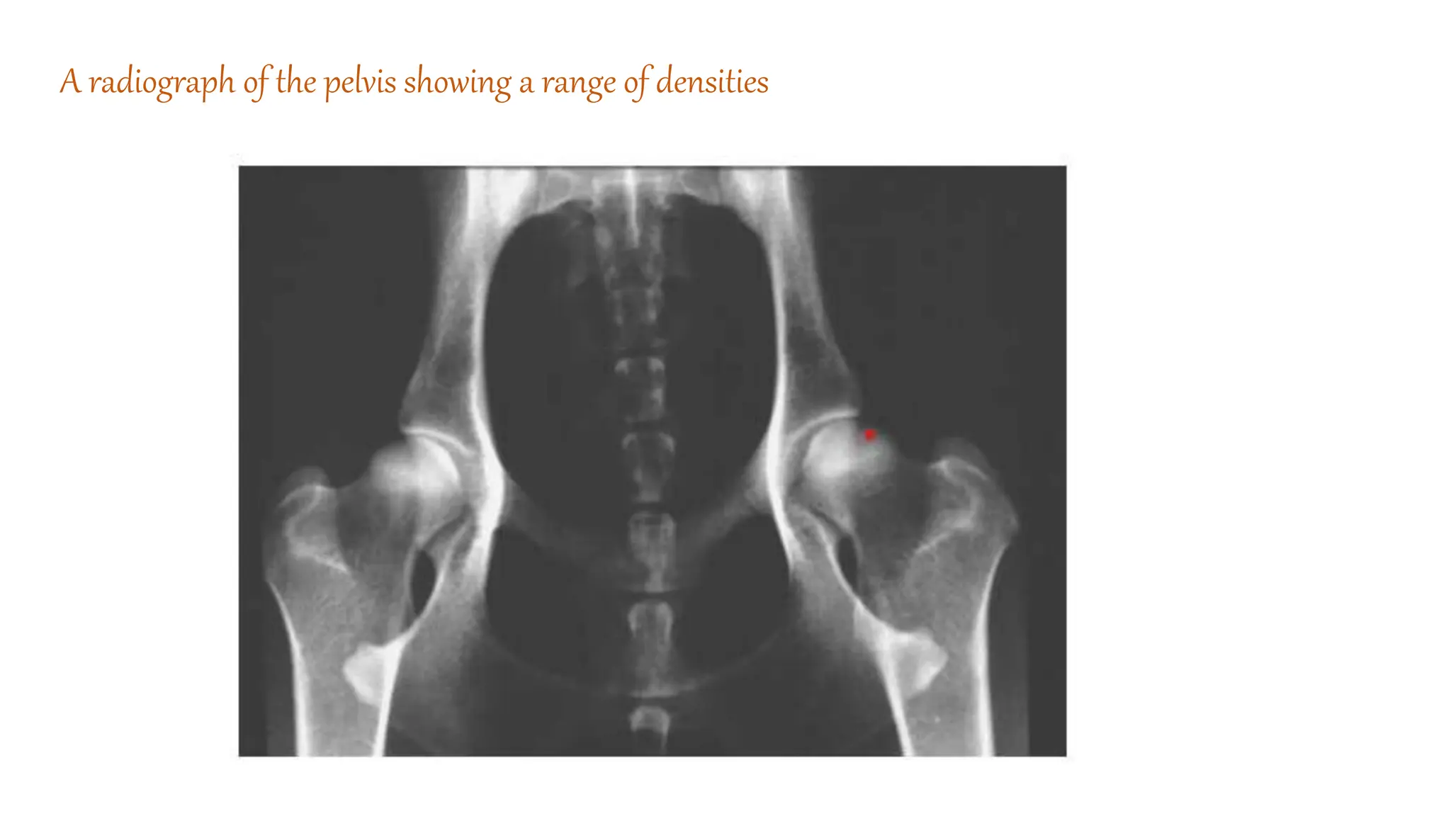 Radiographic Quality, Density, Contrast, Detail, Radiographic ...