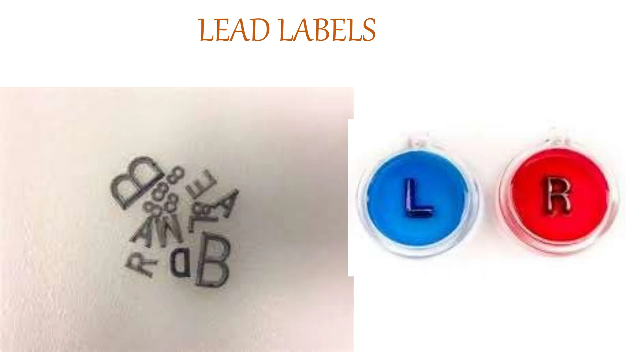 Radiographic Quality, Density, Contrast, Detail, Radiographic ...