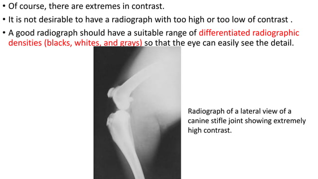 Radiographic Quality, Density, Contrast, Detail, Radiographic ...