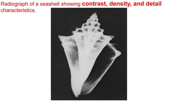 Radiographic Quality, Density, Contrast, Detail, Radiographic ...