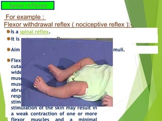 Flexor Withdrawal Reflex Baby