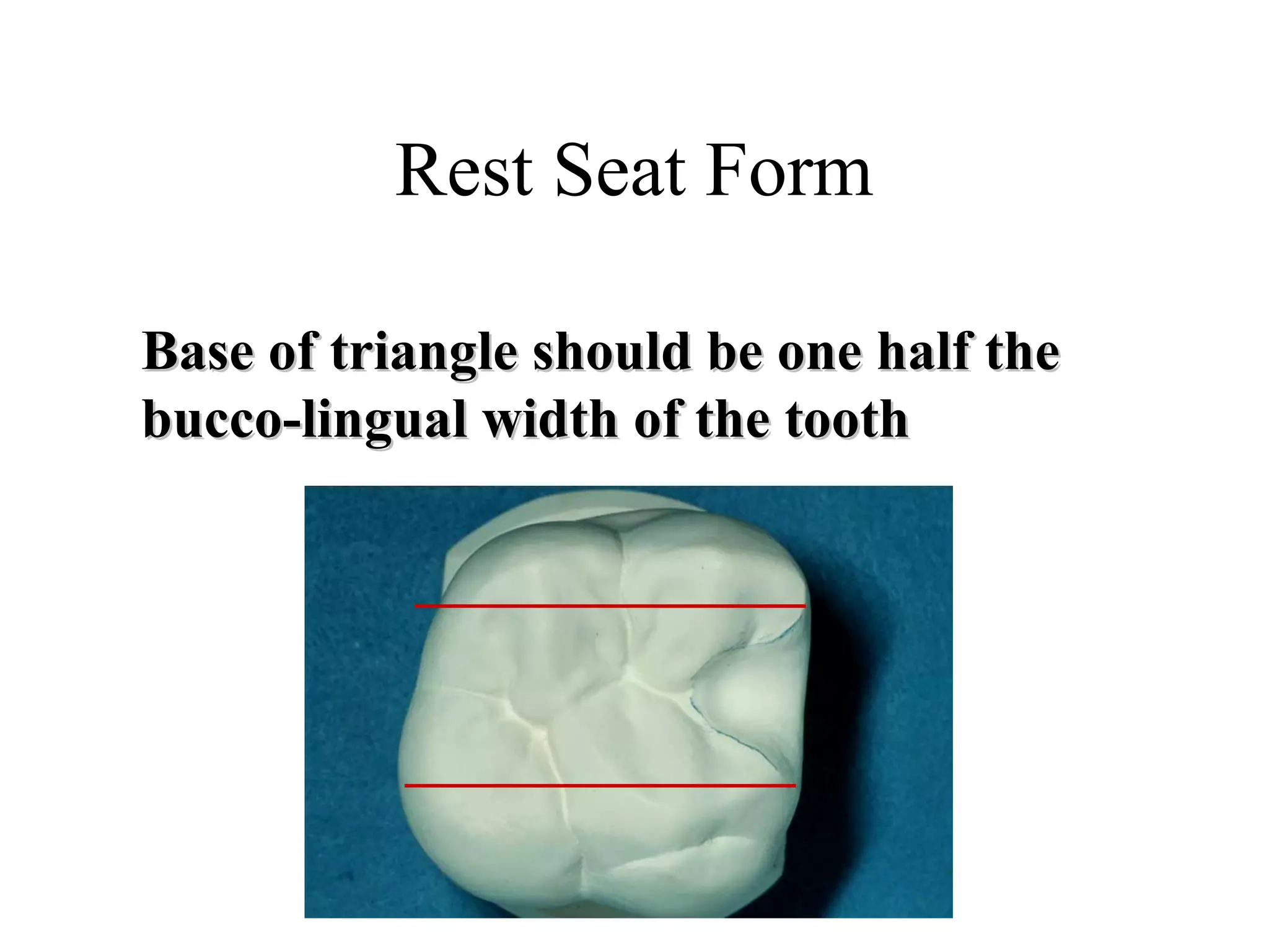 4 rests and rest seats | PPT