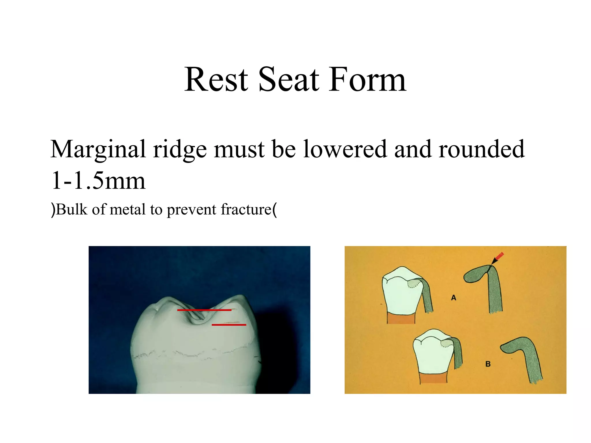 4 rests and rest seats | PPT