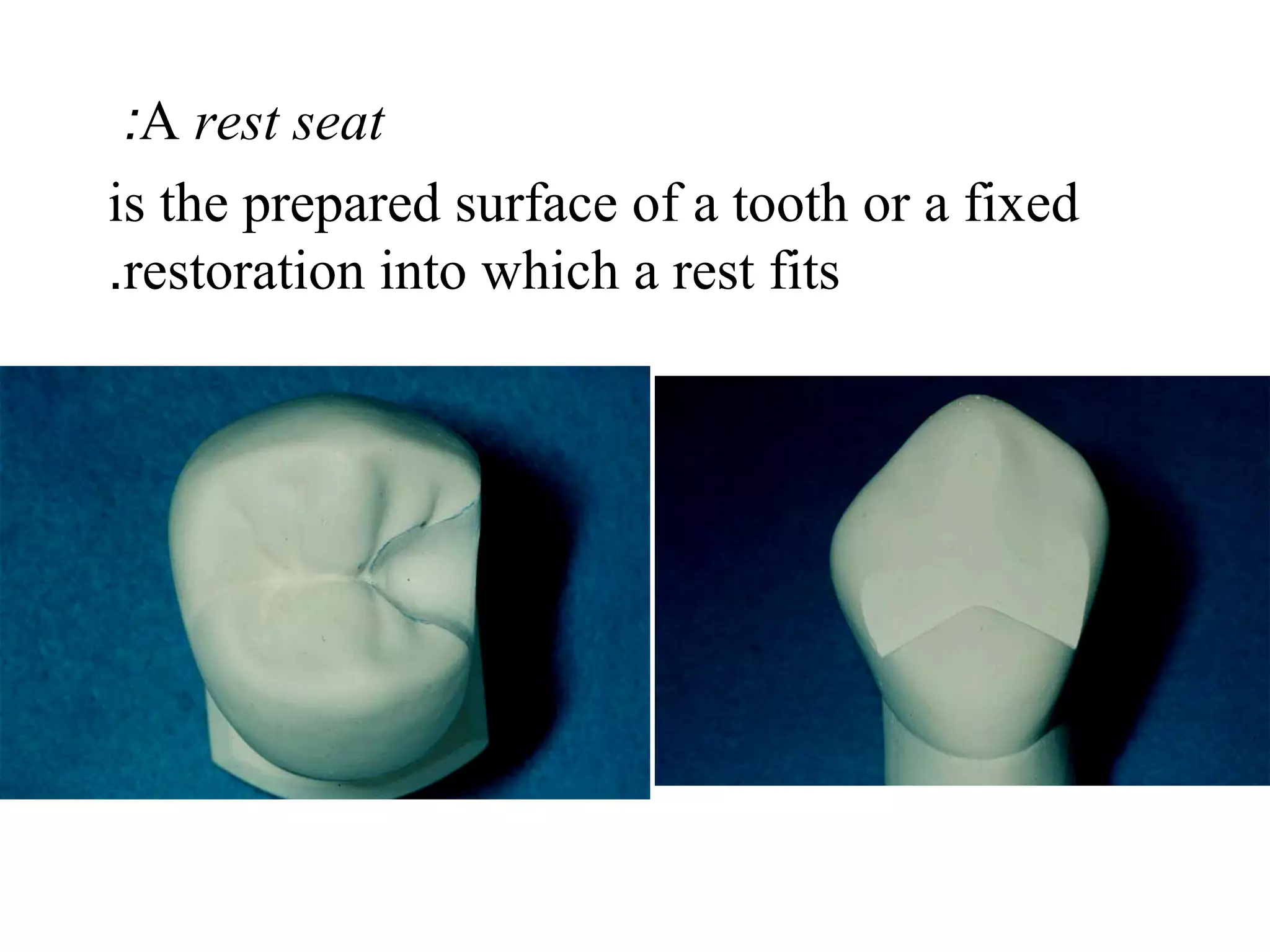 4 rests and rest seats | PPT