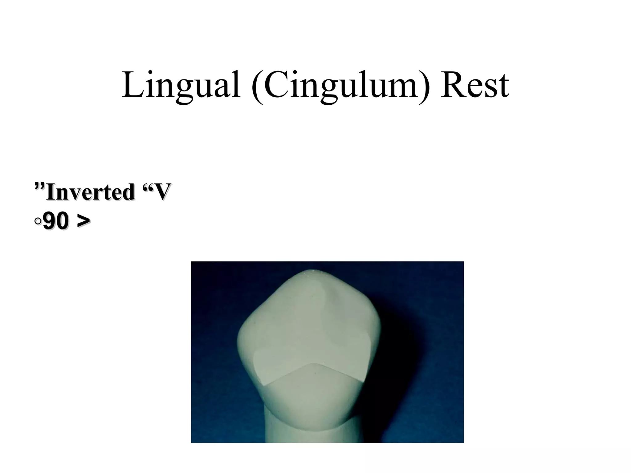 4 rests and rest seats | PPT