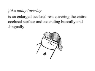 4 rests and rest seats | PPT