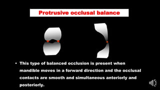 4- Revision >> Concepts of occlusion for 4th year Students. | PPTX