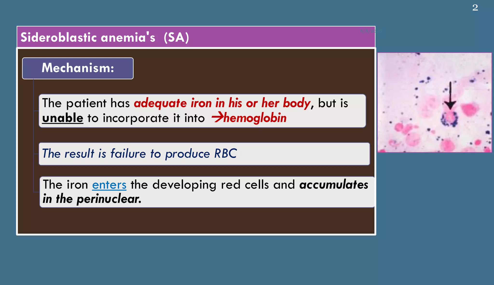 Sederoblastic anemia | PDF