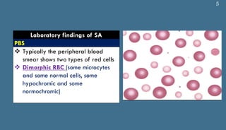 Sederoblastic anemia | PDF