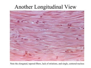 Smooth Muscle Slide Labeled