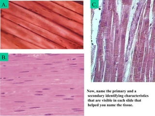 Smooth Muscle Slides