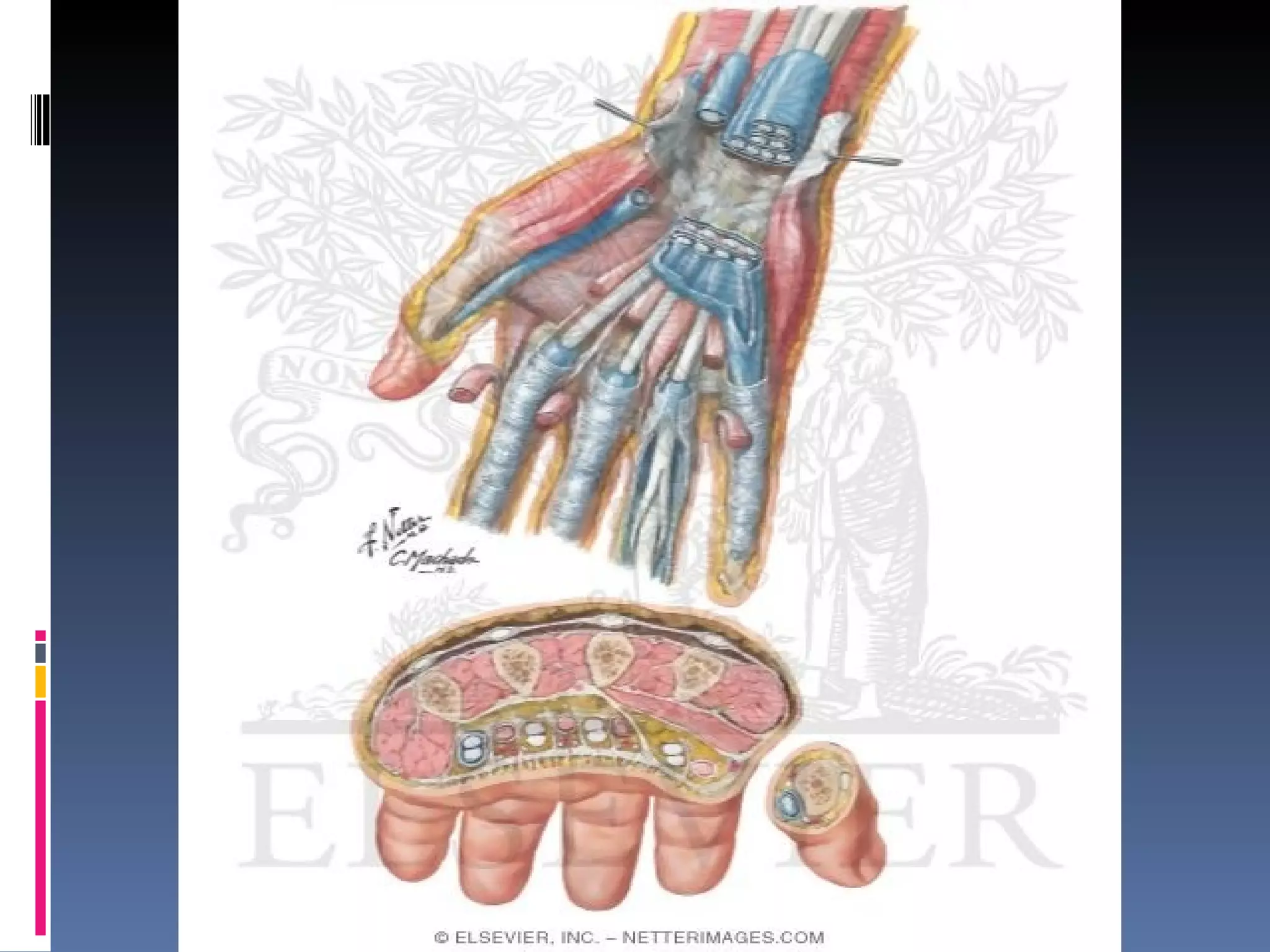 4. spaces of the hand & its applied anatomy[1] | PPT