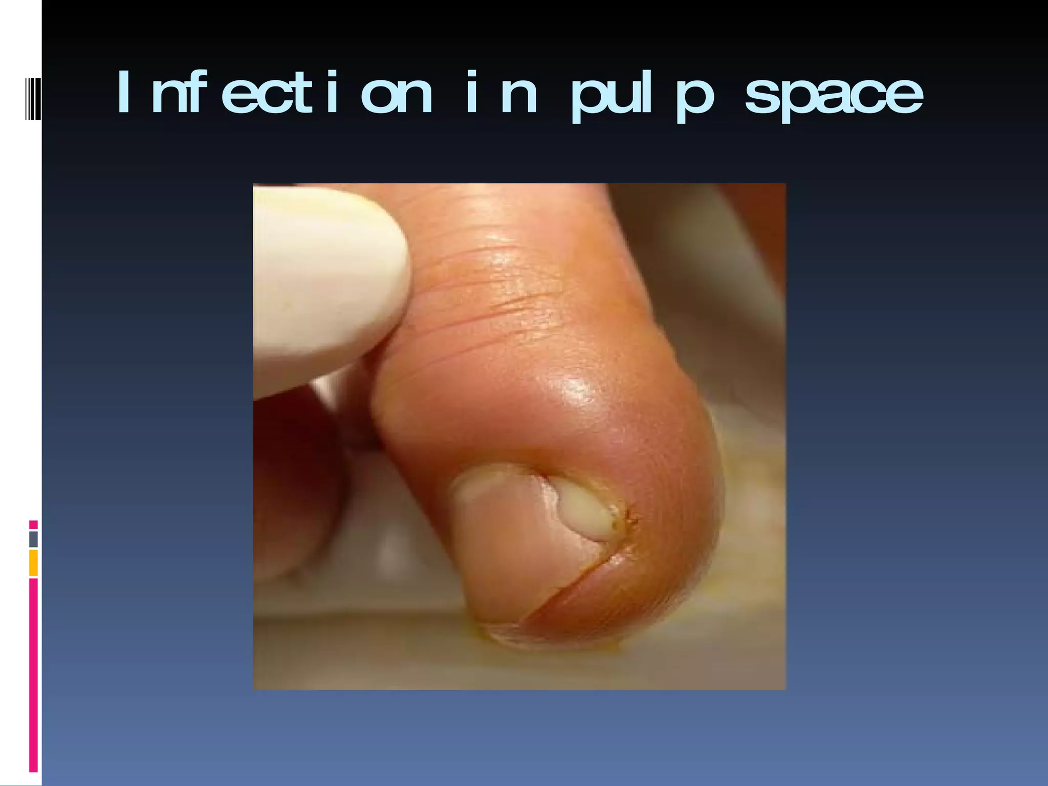 4. spaces of the hand & its applied anatomy[1] | PPT