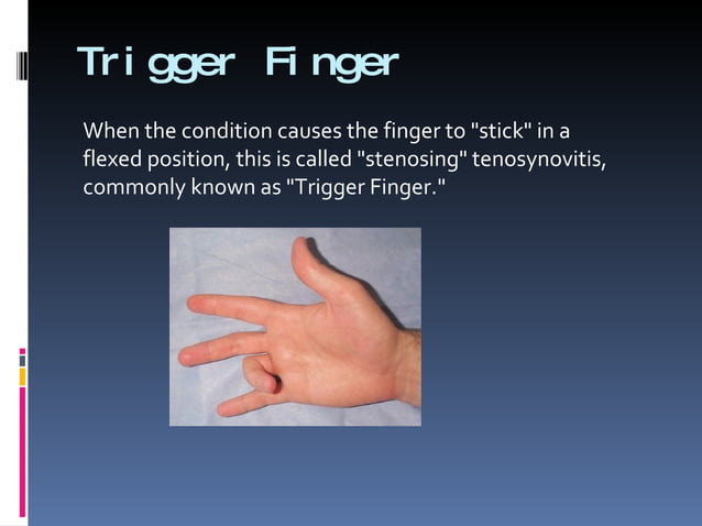 4. spaces of the hand & its applied anatomy[1] | PPT