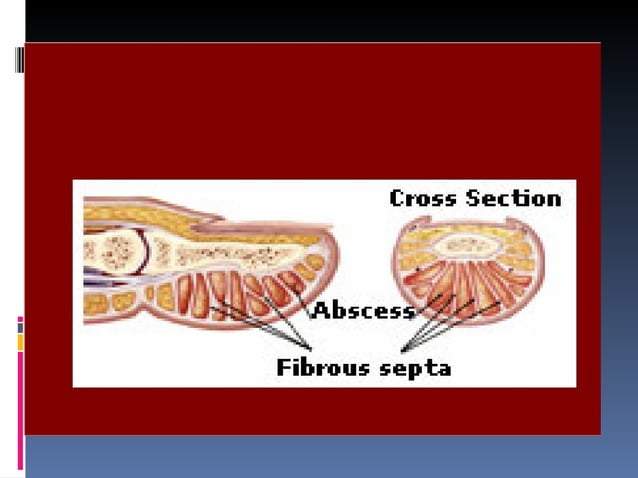 4. spaces of the hand & its applied anatomy[1] | PPT