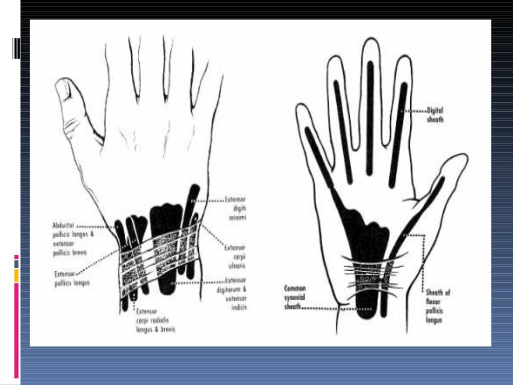 4. spaces of the hand & its applied anatomy[1]
