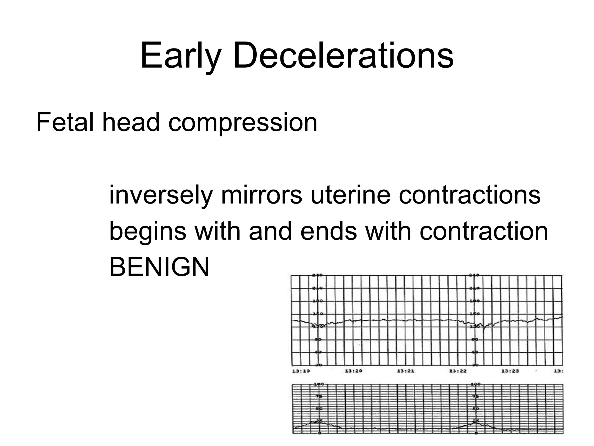 4 Stages of Labor | PPT