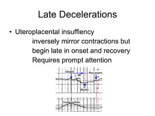 4 Stages of Labor | PPT
