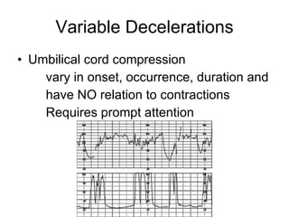 4 Stages of Labor | PPT