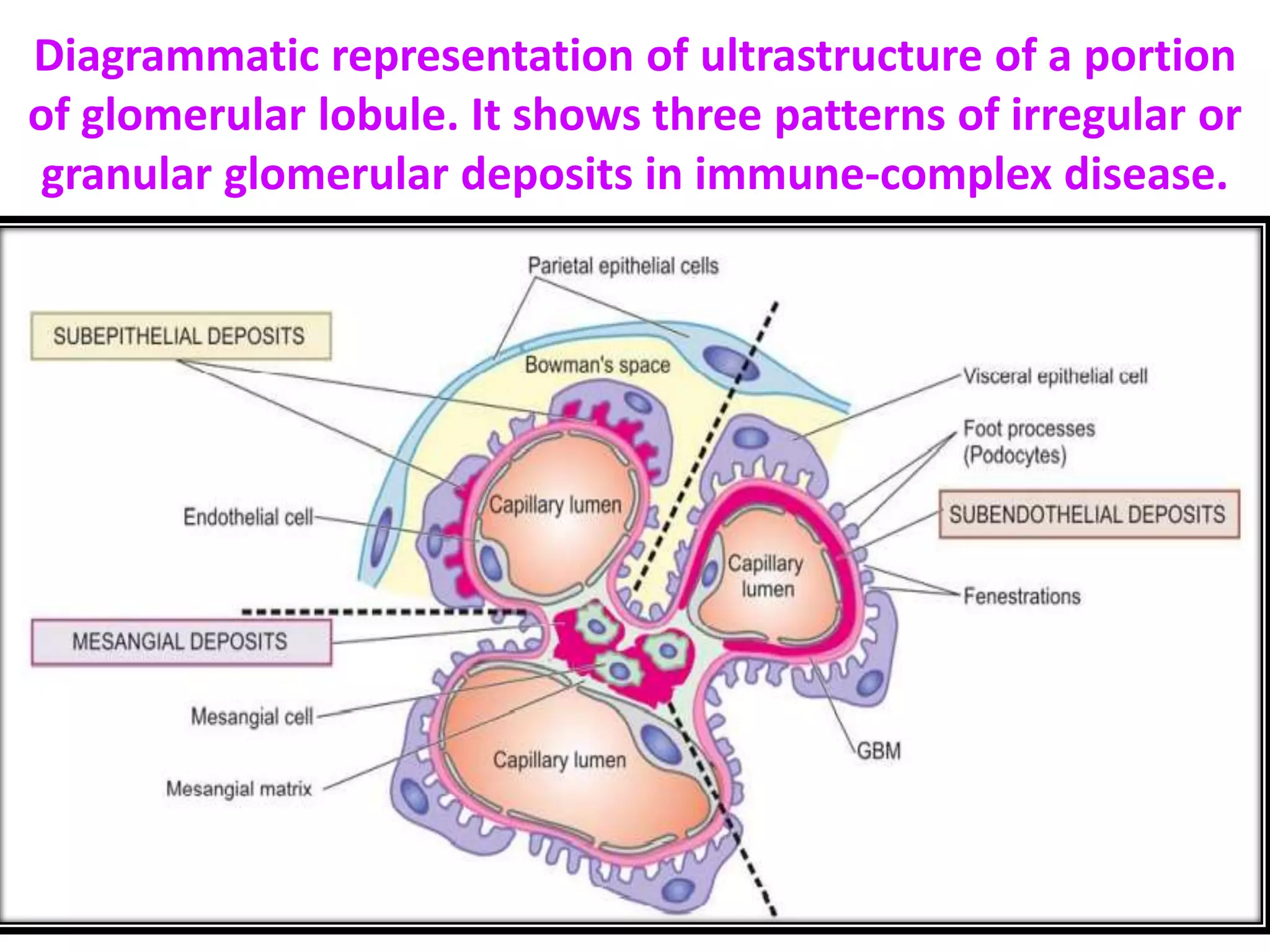 The KIDNEY - PATHOGENESIS OF GLOMERULAR DISEASES | PPTX