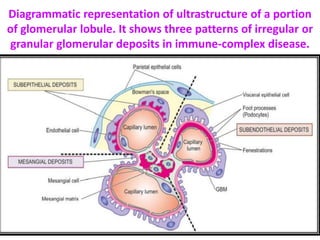 The KIDNEY - PATHOGENESIS OF GLOMERULAR DISEASES | PPTX