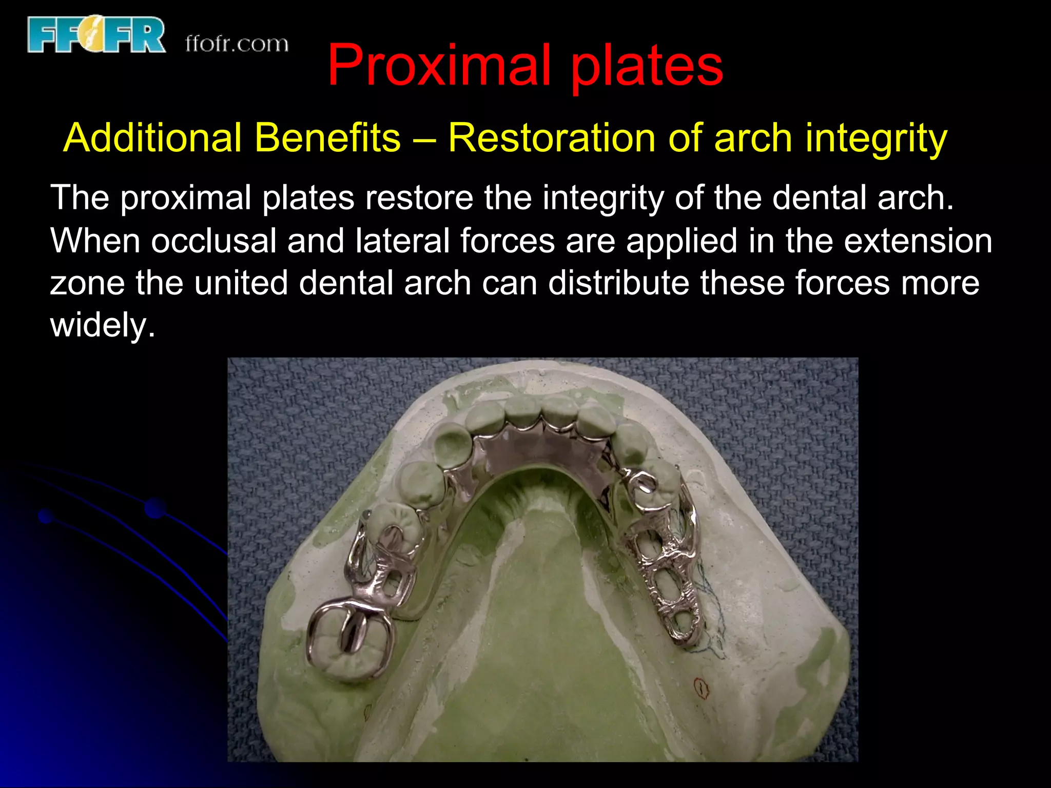4.the tooth tissue junction, major and minor connectors | PPT