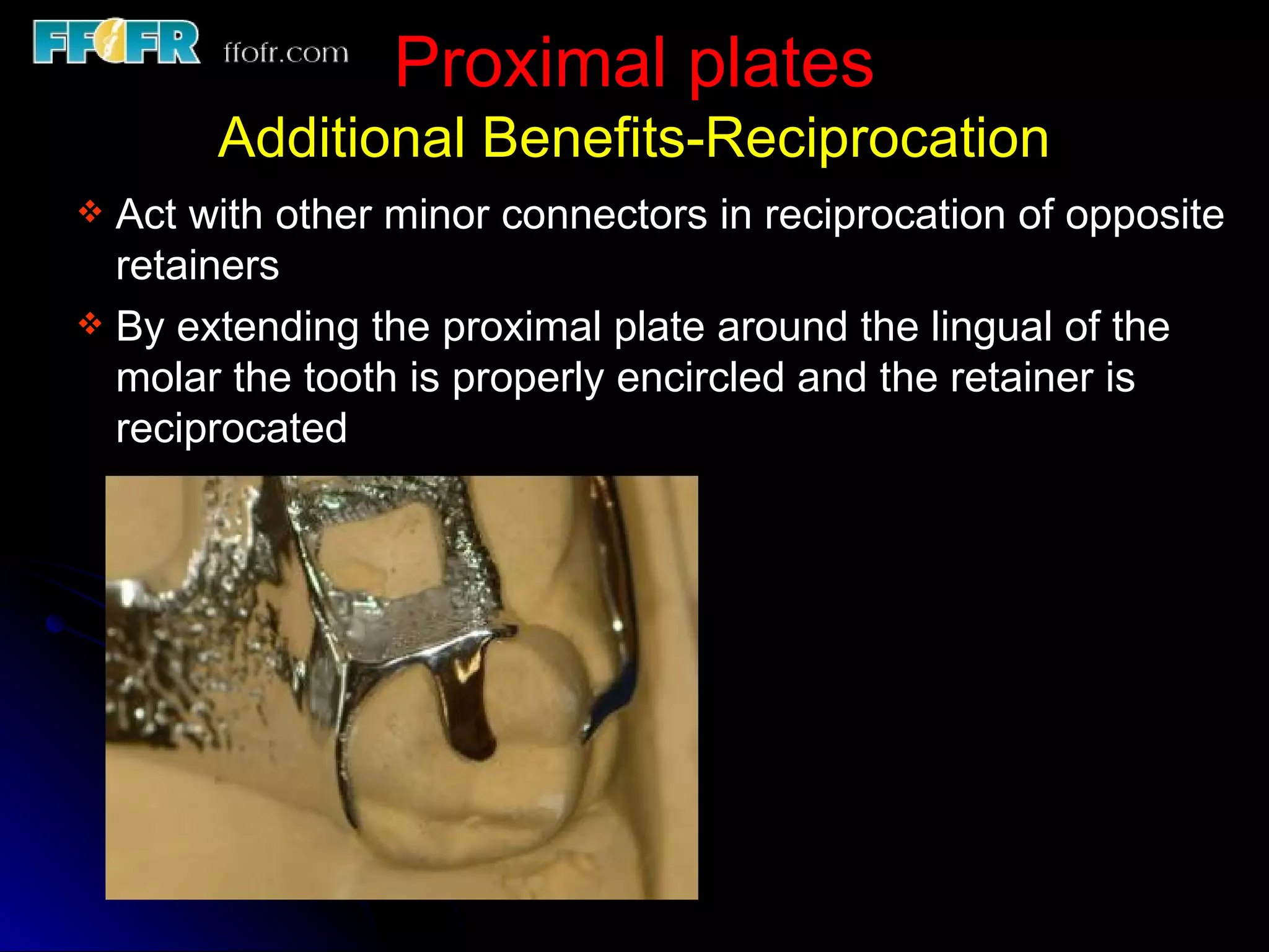 4.the tooth tissue junction, major and minor connectors | PPT
