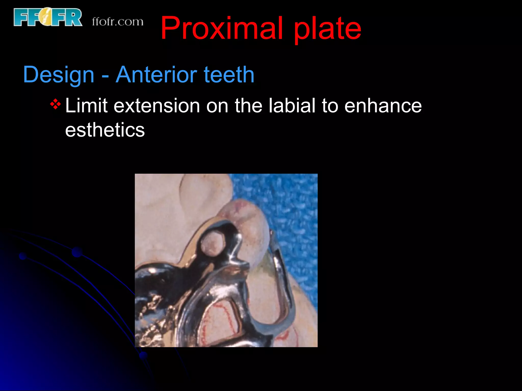 4.the tooth tissue junction, major and minor connectors | PPT