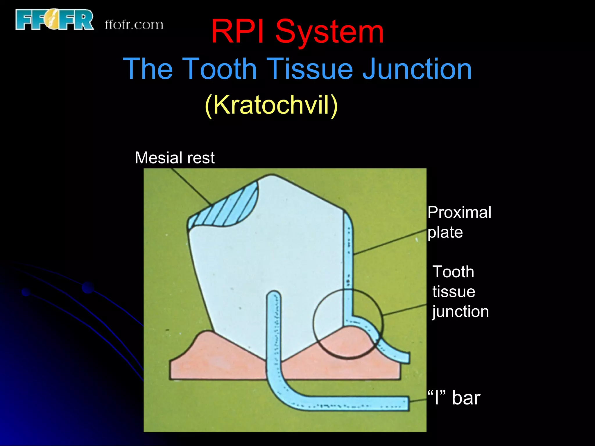 4.the tooth tissue junction, major and minor connectors | PPT