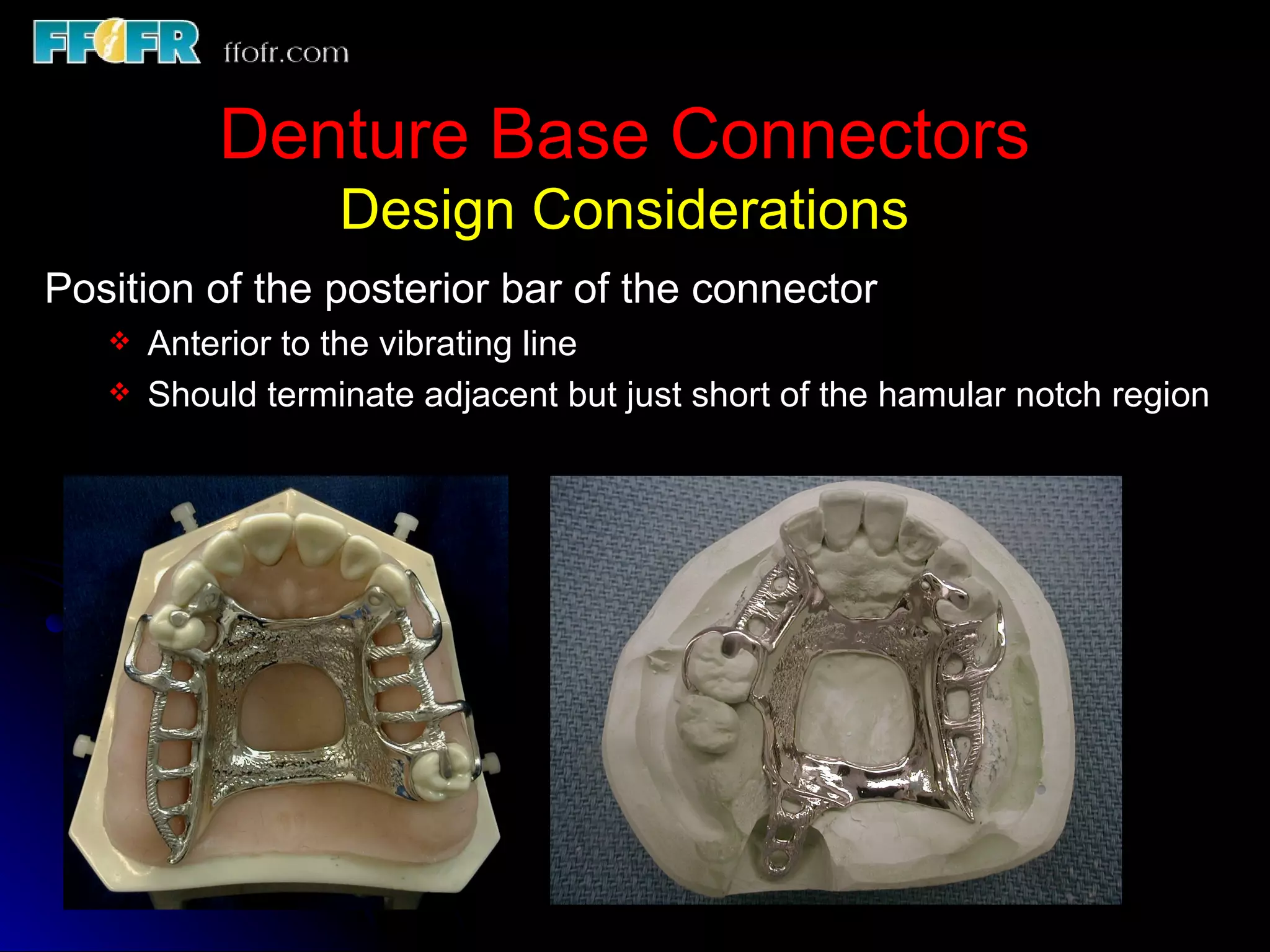 4.the tooth tissue junction, major and minor connectors | PPT