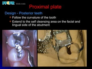 4.the tooth tissue junction, major and minor connectors | PPT