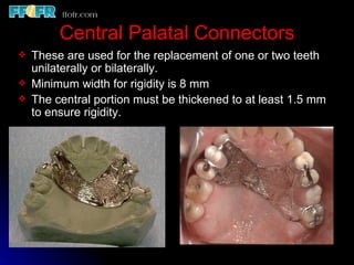 4.the tooth tissue junction, major and minor connectors | PPT