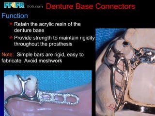 4.the tooth tissue junction, major and minor connectors | PPT