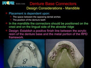 4.the tooth tissue junction, major and minor connectors | PPT