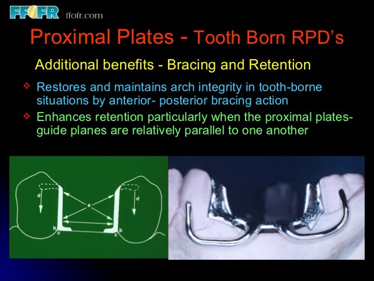 4.the tooth tissue junction, major and minor connectors