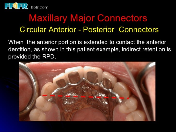 4.the tooth tissue junction, major and minor connectors