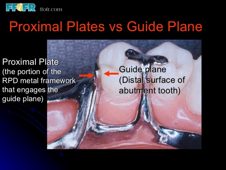 4.the tooth tissue junction, major and minor connectors
