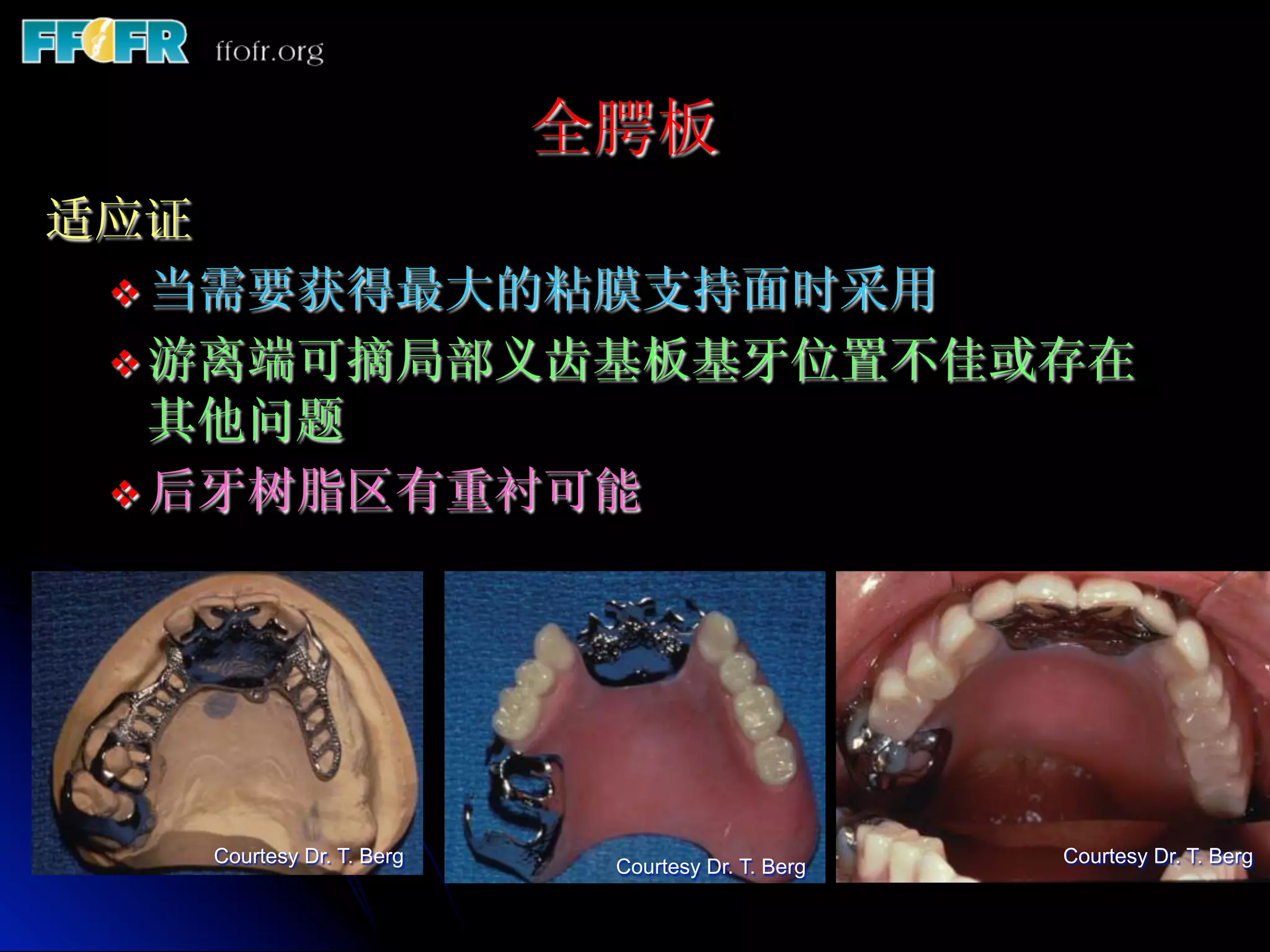 4.the tooth tissue junction, major and minor connectors | PPT