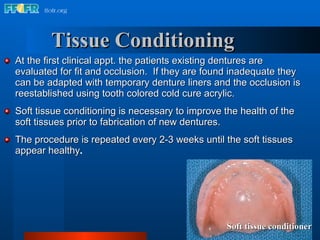 4.tissue conditioning | PPT