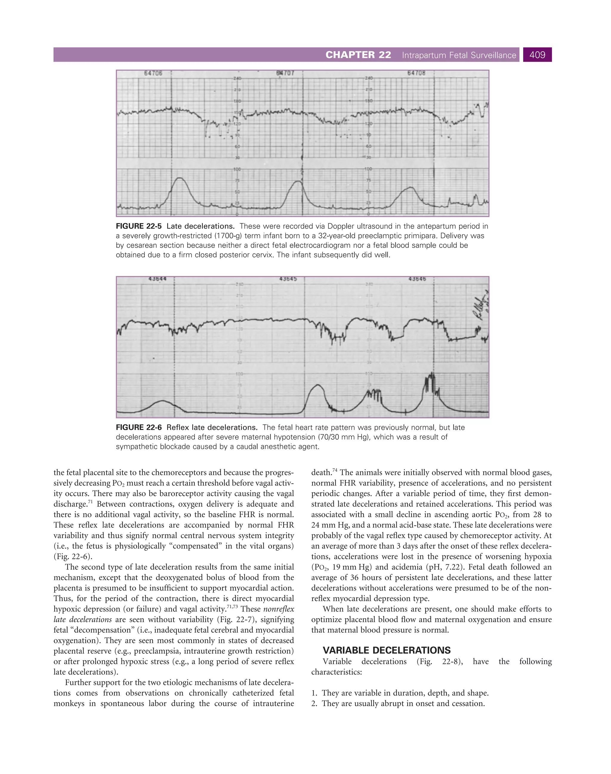4 u1.0-b978-1-4160-4224-2..50024-7..docpdf | PDF